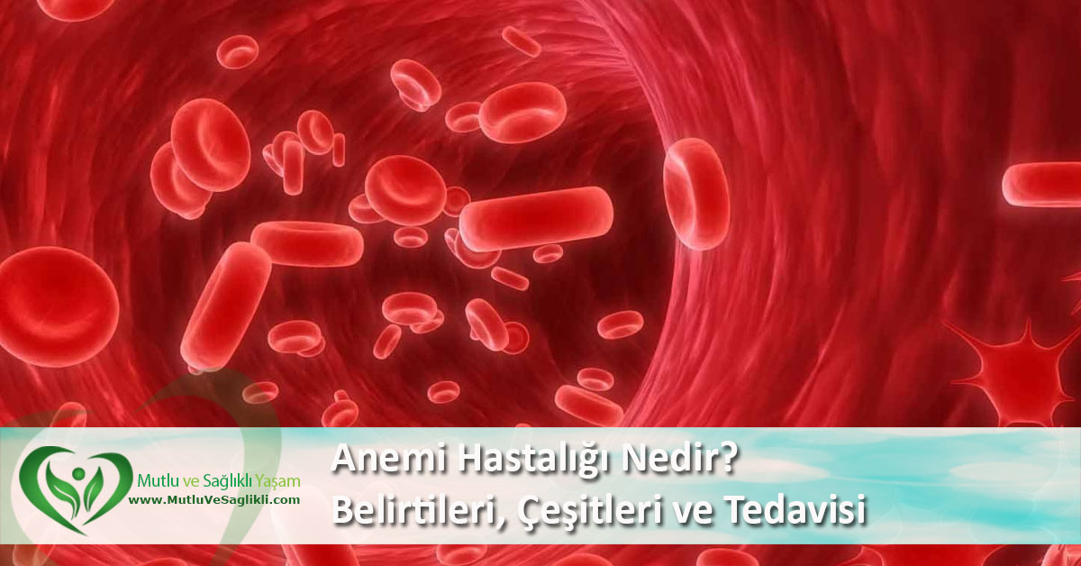 Anemi Hastalığı Nedir? Belirtileri, Çeşitleri ve Tedavisi