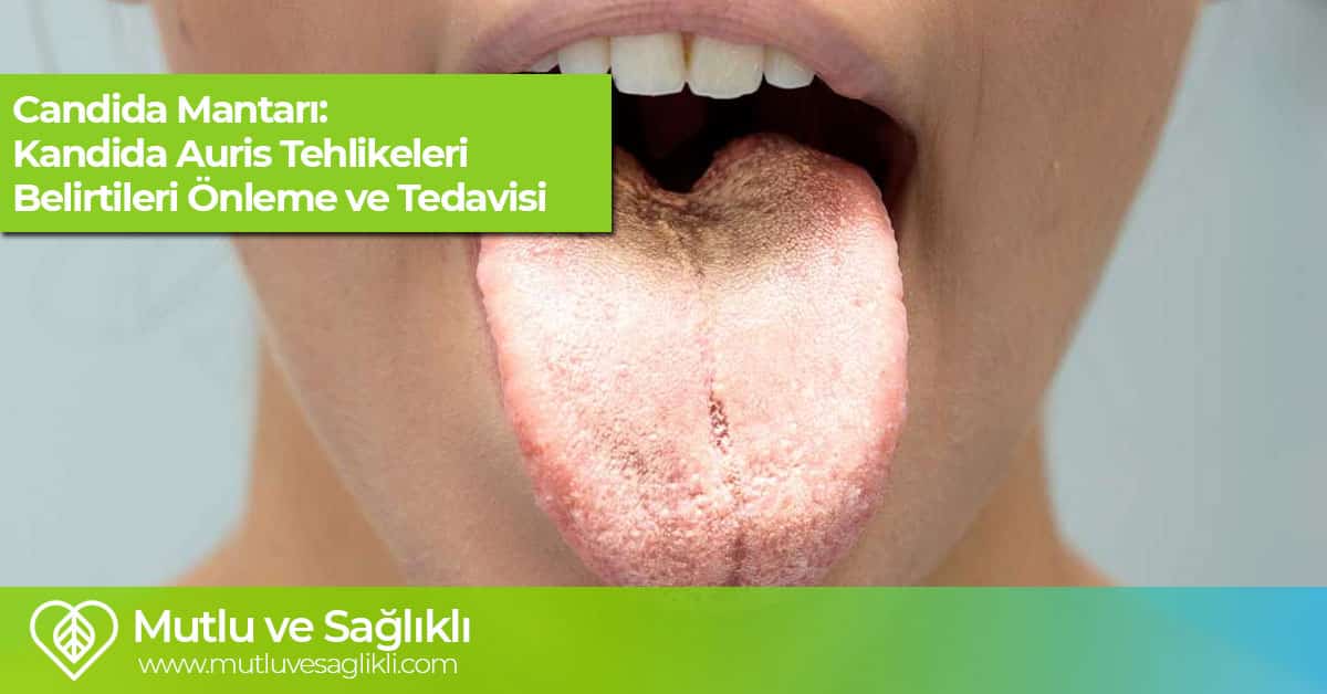 Candida Mantarı: Kandida Auris Belirtileri ve Tedavisi