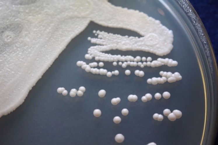 Candida Mantarı: Kandida Auris Belirtileri ve Tedavisi