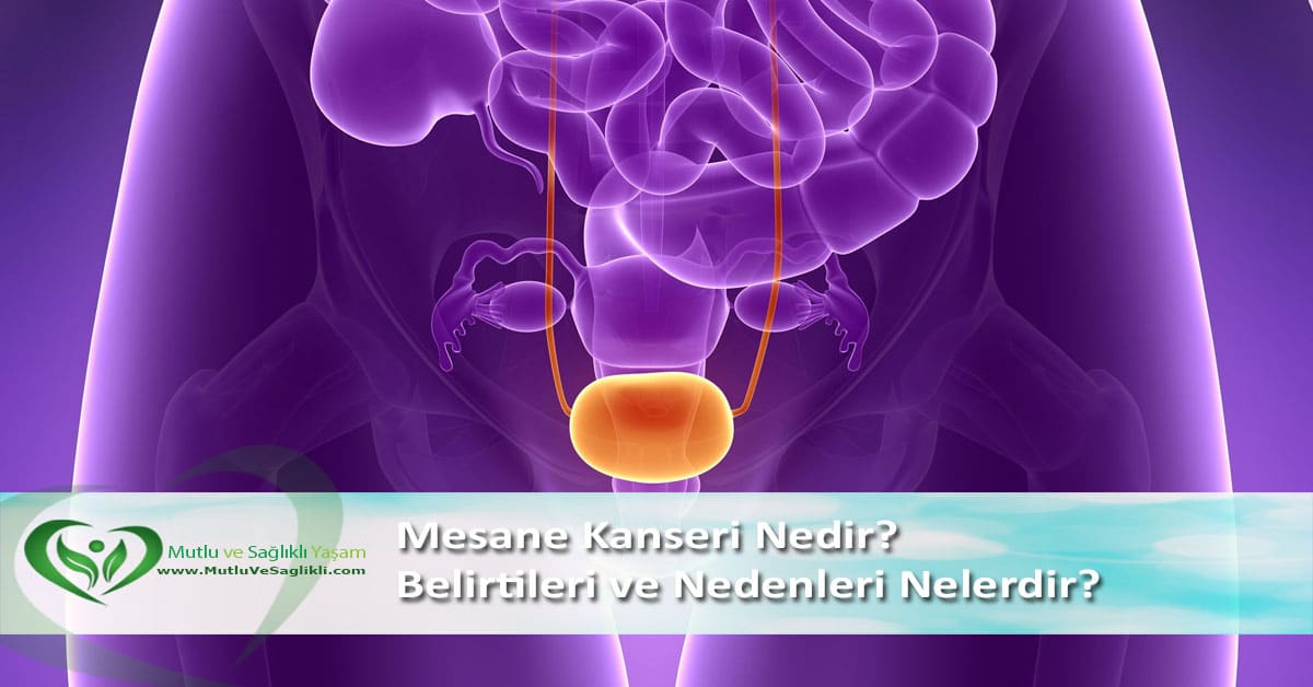 Mesane Kanseri Nedir? Mesane Kanseri Belirtileri ve Nedenleri