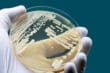 Candida Mantarı: Belirtileri, Nedenleri, Tedavisi ve Candida Diyeti